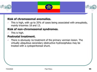 Abnormalities of the Fetal Central Nervous System Prenatal US Diagnosis ...