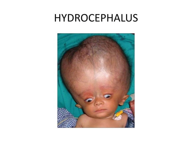 ABNORMALITIES OF THE NEWBORN. BABY.pptx