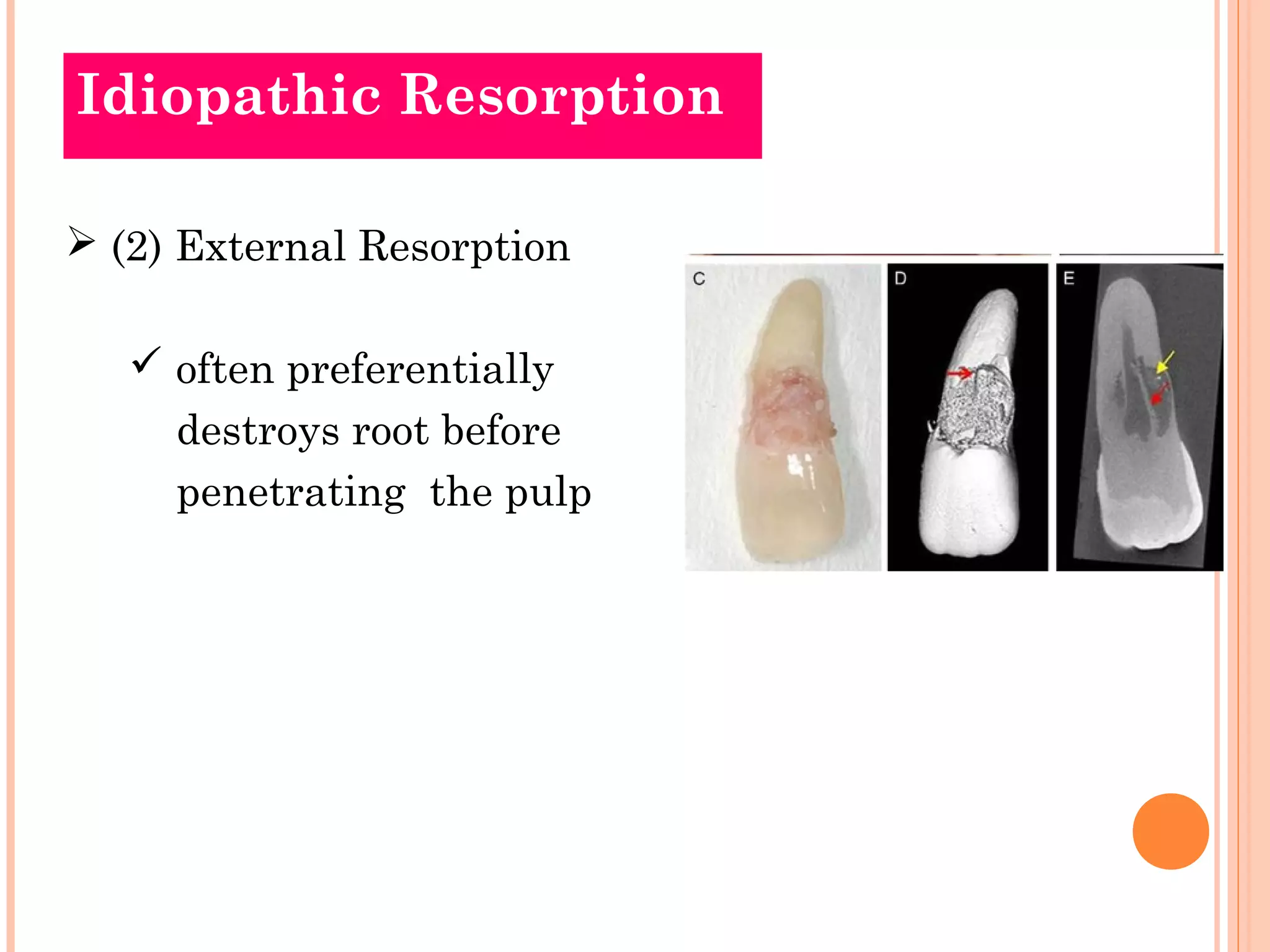 Abnormalities of the pulp | PPT
