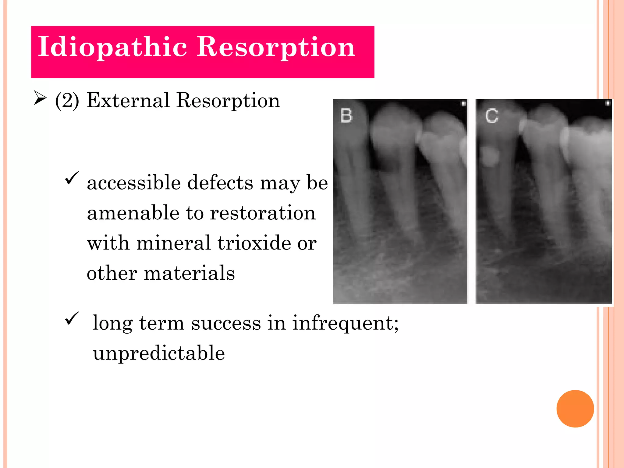 Abnormalities of the pulp | PPT