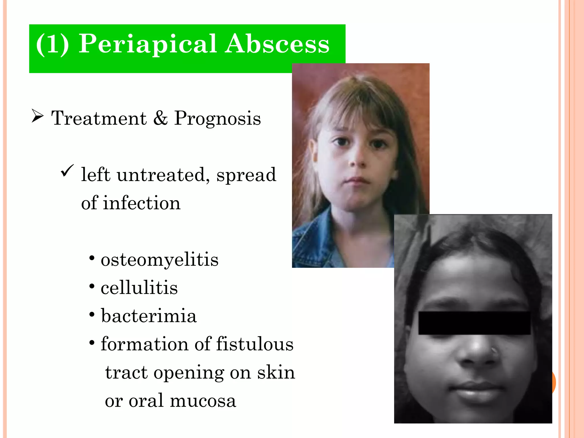 Abnormalities of the pulp | PPT