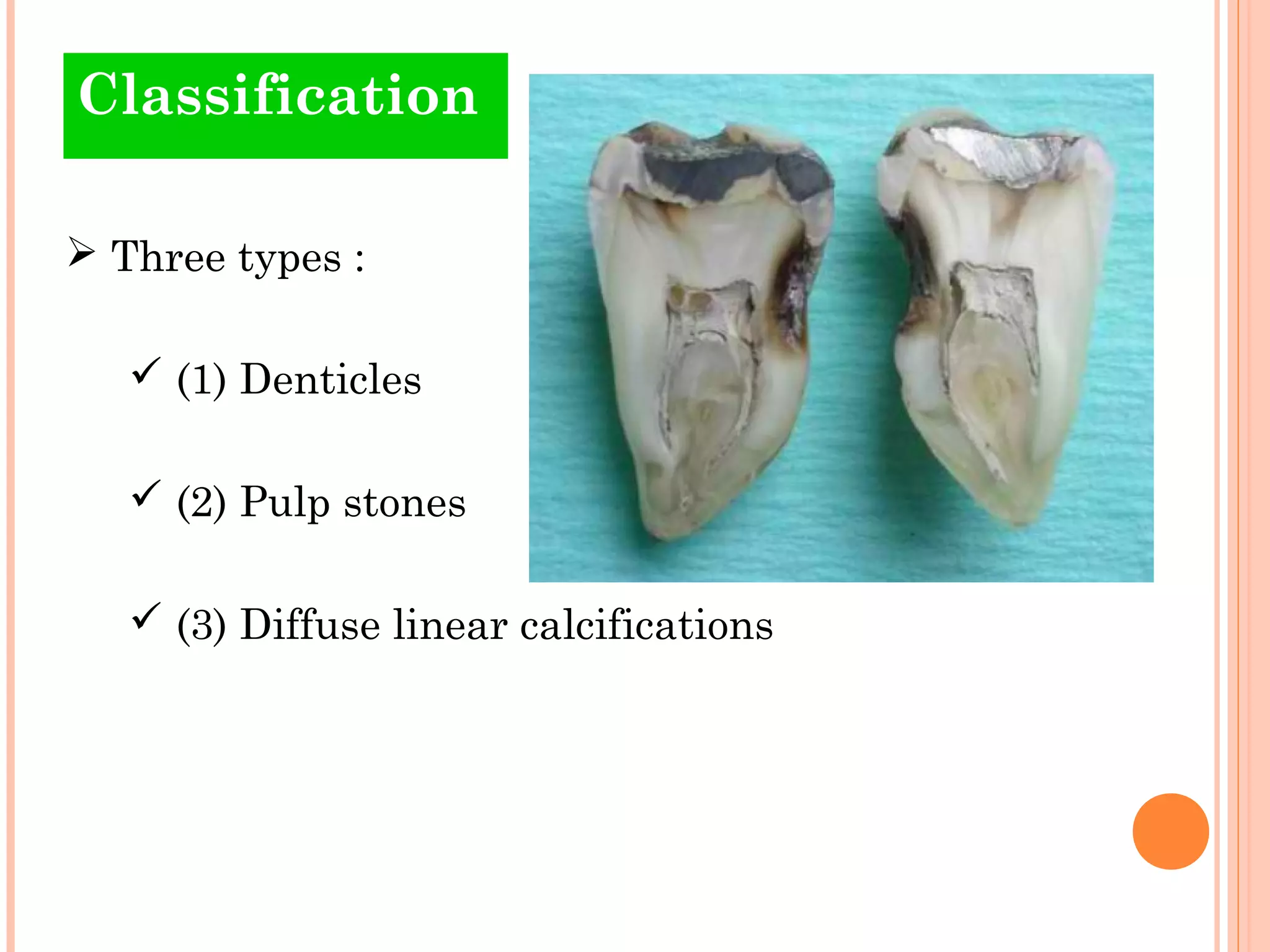 Abnormalities of the pulp | PPT