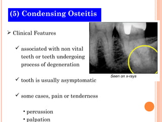 Condensing Osteitis