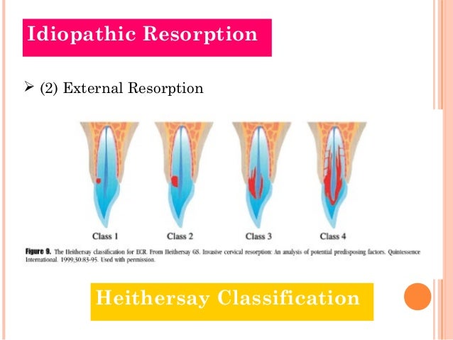 Abnormalities of the pulp