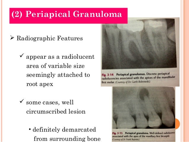 Abnormalities of the pulp