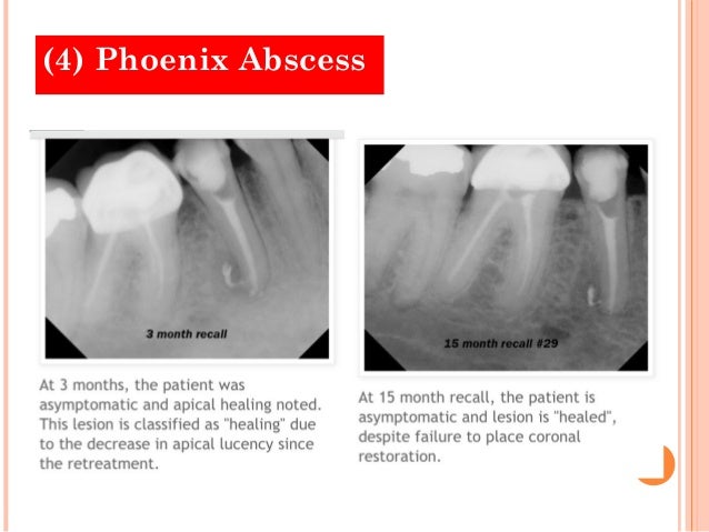 Abnormalities of the pulp