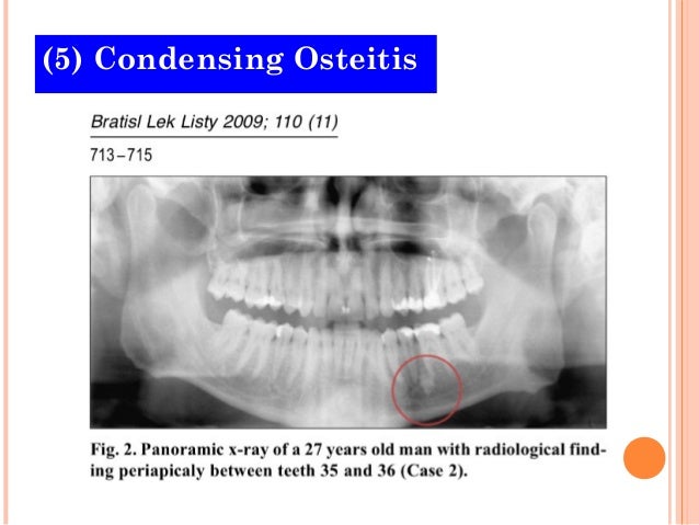 Abnormalities of the pulp
