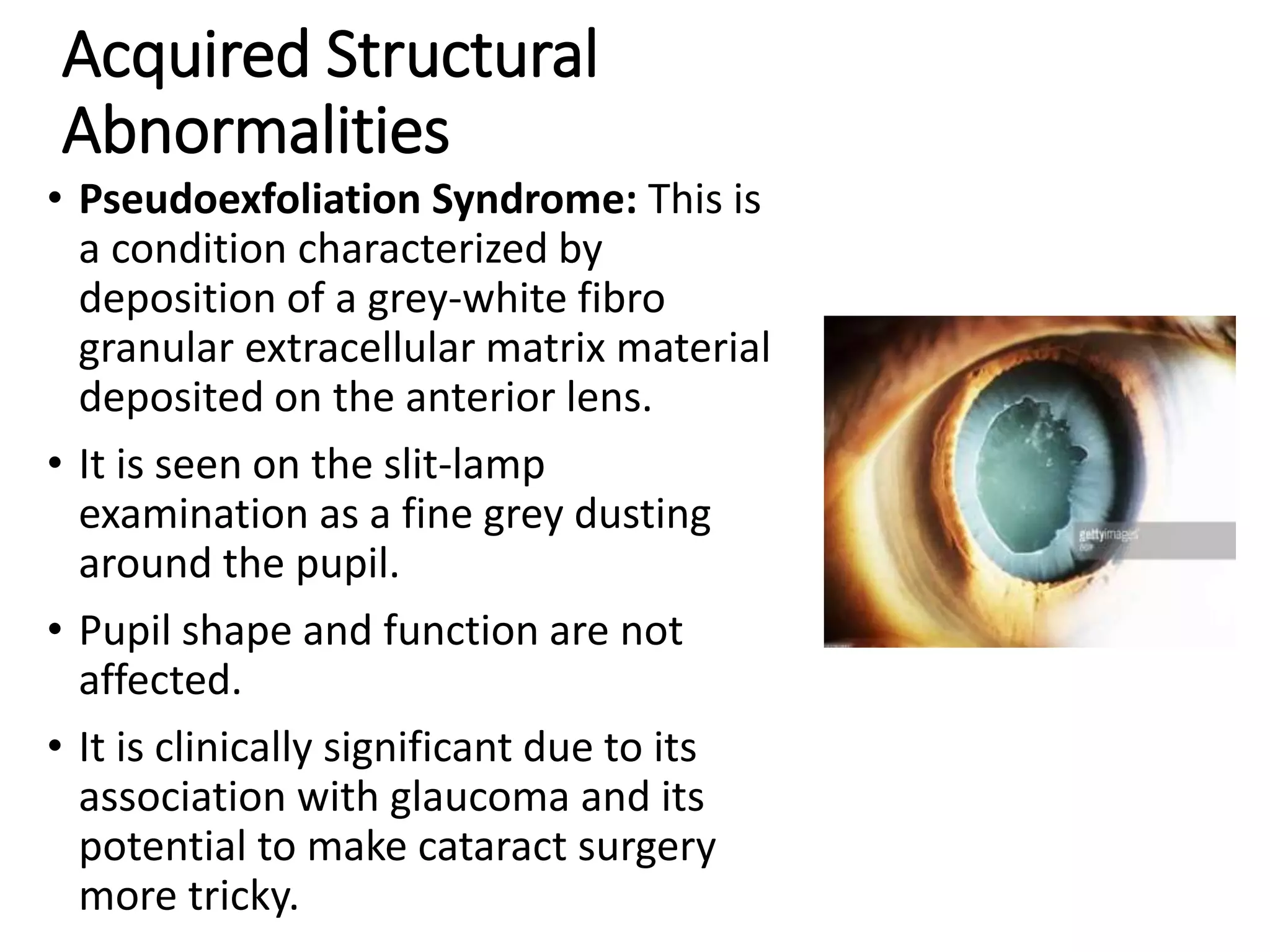 Abnormalities of the Pupil.pptx