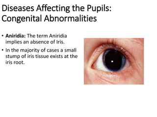 Abnormalities of the Pupil.pptx