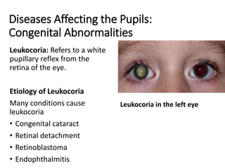 Abnormalities of the Pupil.pptx