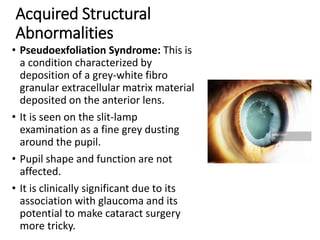 Abnormalities of the Pupil.pptx