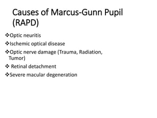 Abnormalities of the Pupil copy copy copy.pptx