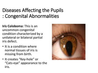 Abnormalities of the Pupil copy copy copy.pptx
