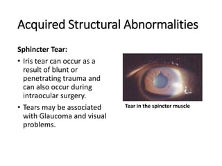 Abnormalities of the Pupil copy copy copy.pptx