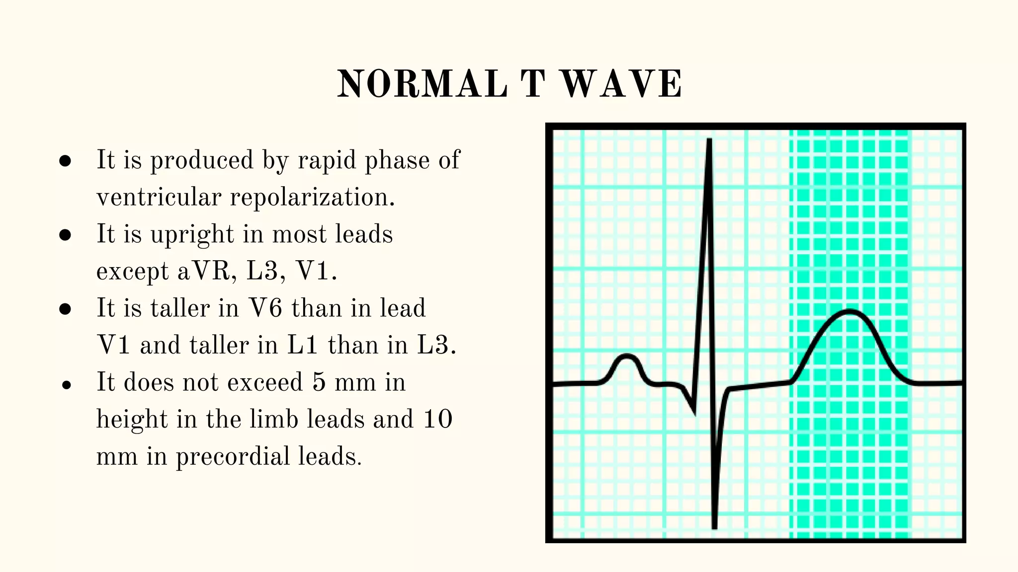 Abnormalities Of T Wave Ppt