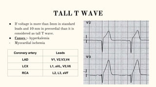 Abnormalities of t wave | PPTX