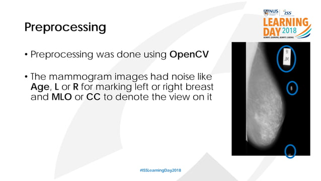 Nus Iss Learning Day 2018 Abnormality Classification Using Convolutional Neural Networks On