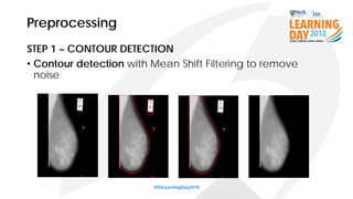 NUS-ISS Learning Day 2018- Abnormality classification using ...