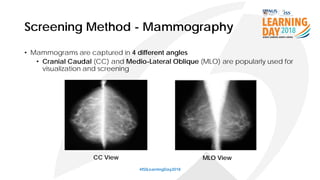 NUS-ISS Learning Day 2018- Abnormality classification using convolutional neural networks on ...