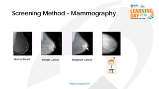 NUS-ISS Learning Day 2018- Abnormality classification using convolutional neural networks on ...