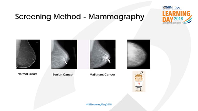 Nus Iss Learning Day 2018 Abnormality Classification Using Convolutional Neural Networks On