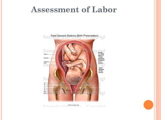 Abnormal Labor - obstructed labour and dystocia | PPT