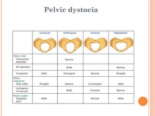 Abnormal Labor - obstructed labour and dystocia | PPT