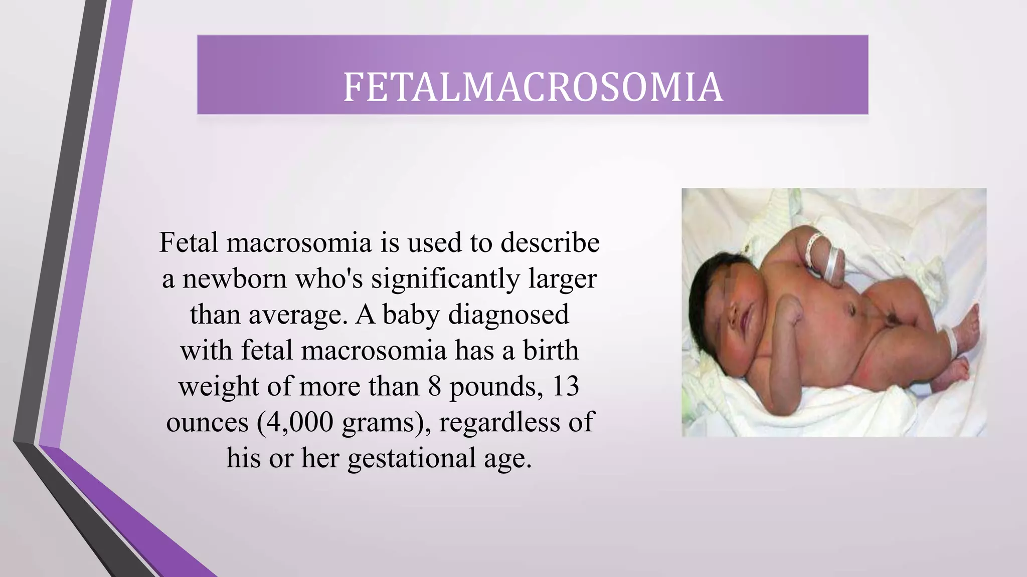 ABNORMAL LABOUR | PPTX