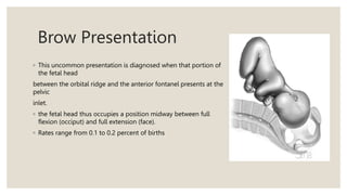 Abnormal labour.pptx