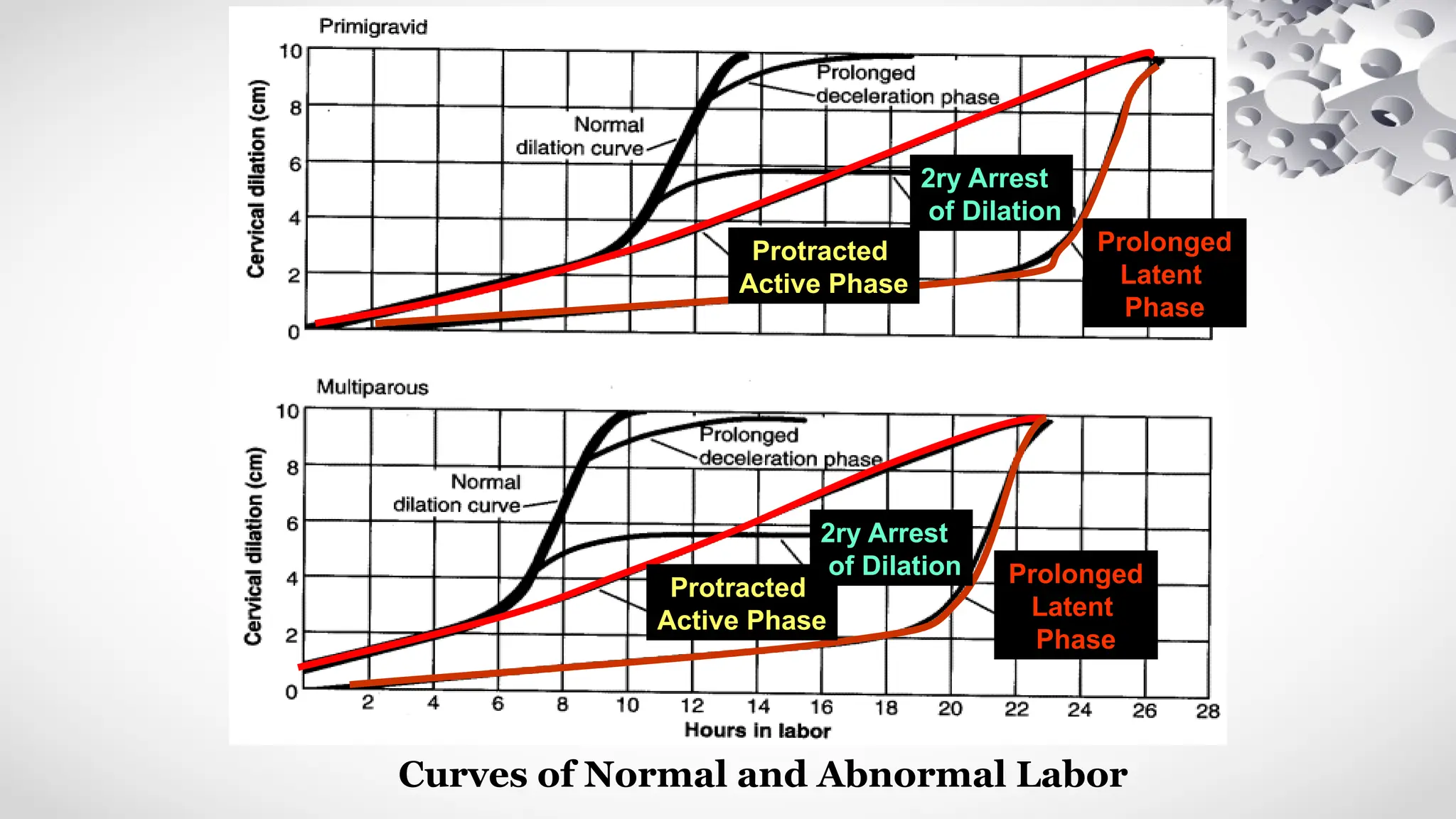 Abnormal_Labour power point presentation | PPT