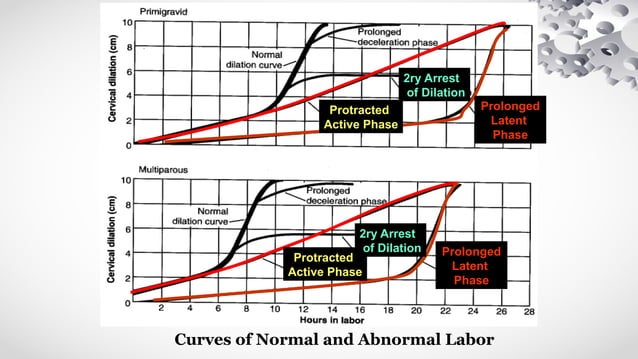 Abnormal_Labour power point presentation | PPT