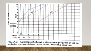 ABNORMAL LABOUR INTRODUCTION ,DEFINITION, ETIOLOGY, RISK FACTORS ...