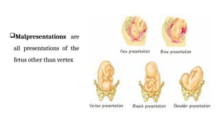 ABNORMAL LABOUR MALPRESENTATIONS & MALPOSITION (1) (1).pptx