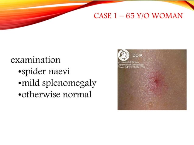 APPROACH TO ABNORMAL LFT | PPTX | Blood Disorders | Diseases and Conditions