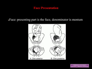 Abnormal lie & presentation | PDF