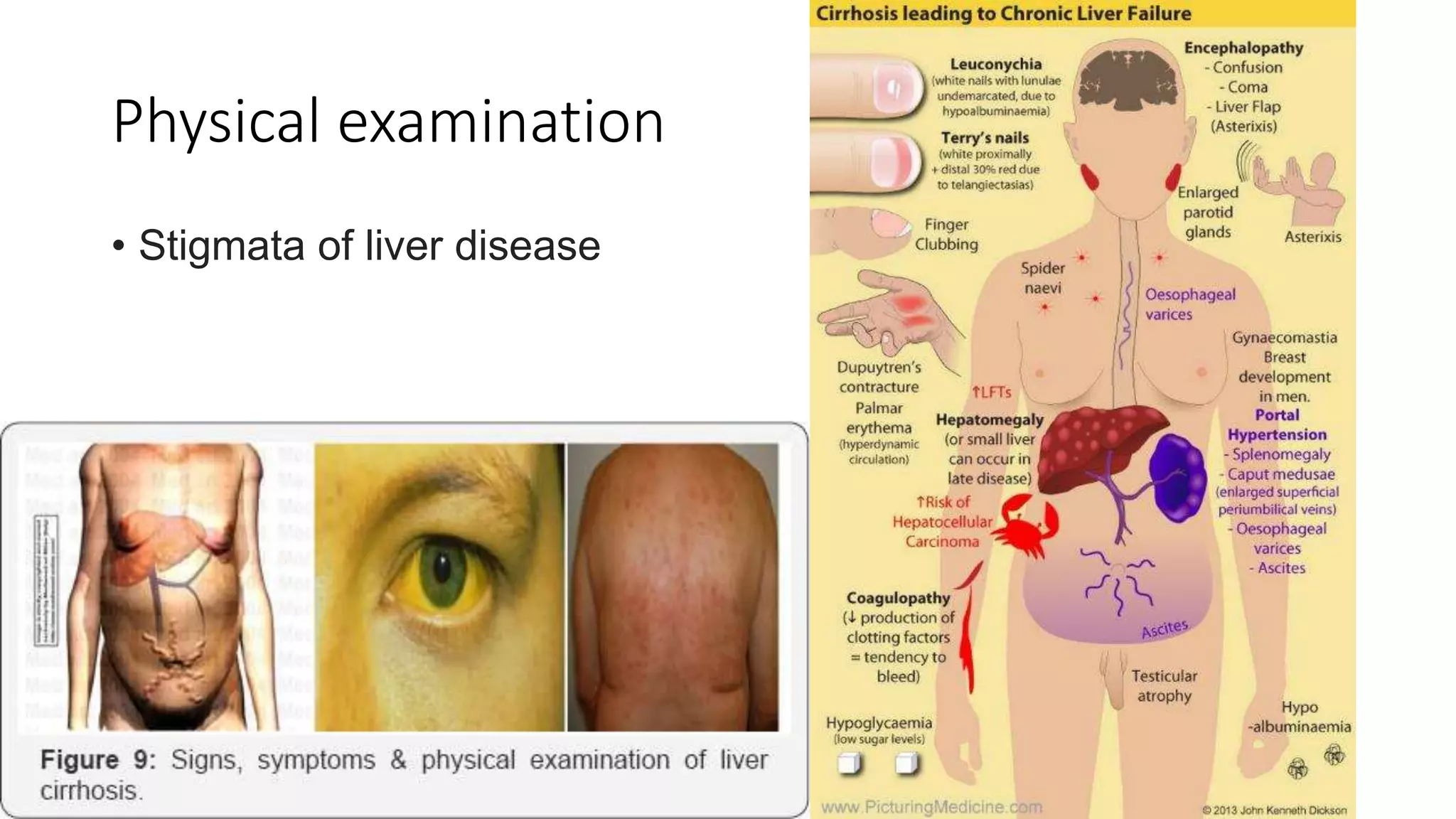 Abnormal liver function tests | PPTX