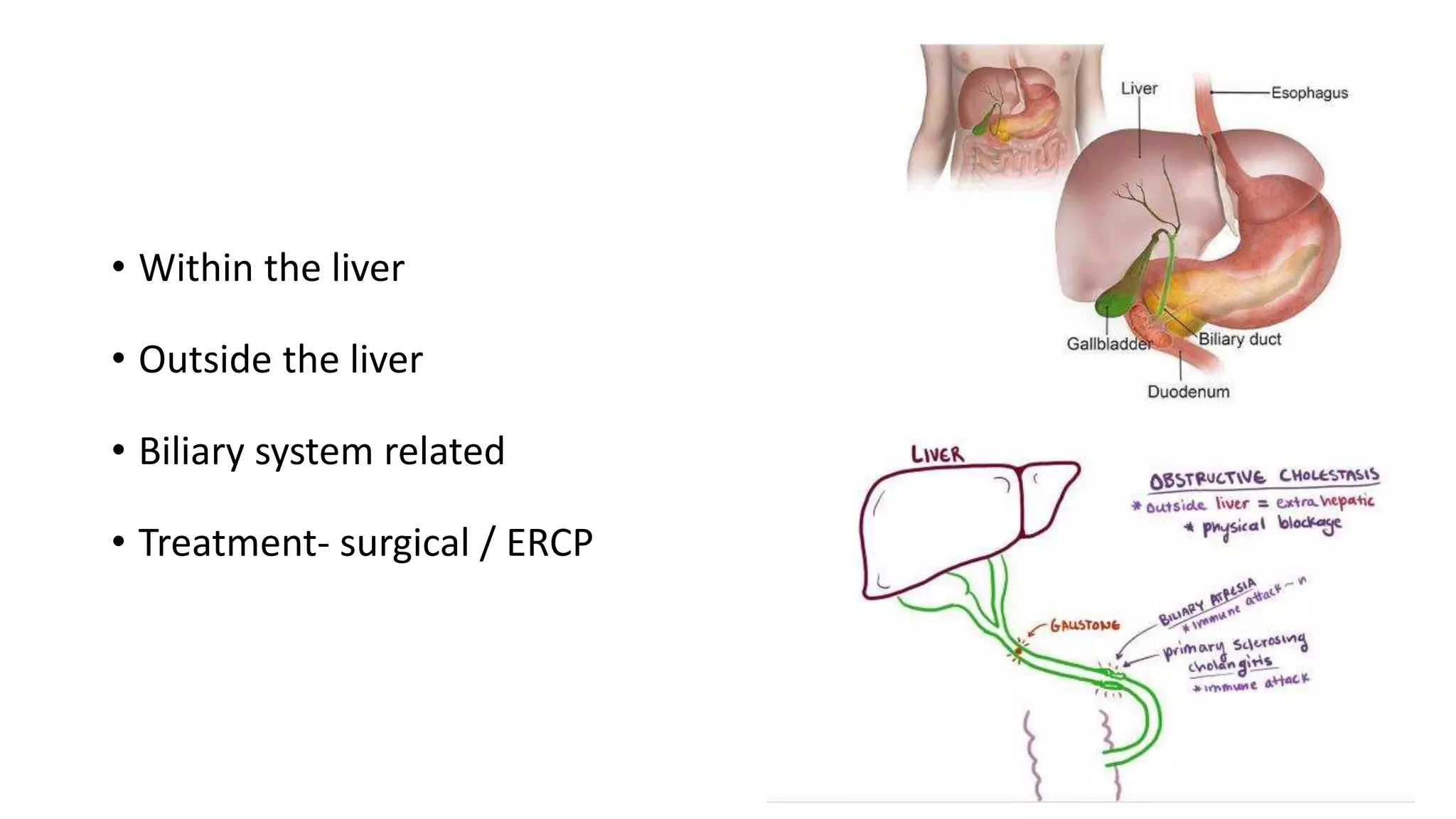 Abnormal liver function tests | PPTX