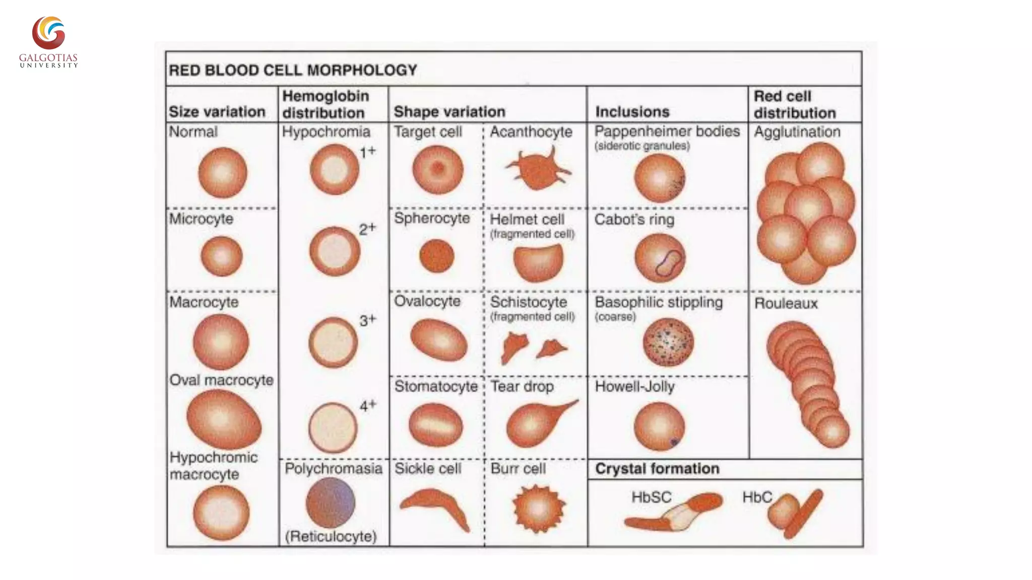 Abnormal morphology of rbc notes | PDF