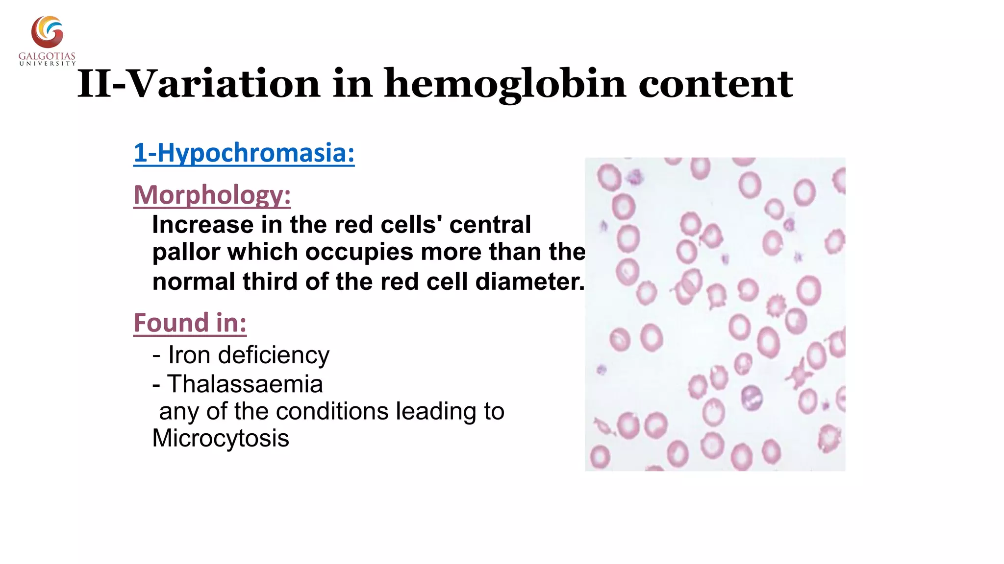 Abnormal morphology of rbc notes | PDF