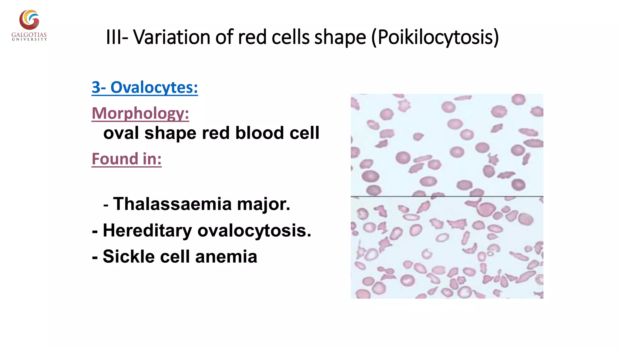 Abnormal morphology of rbc notes | PDF