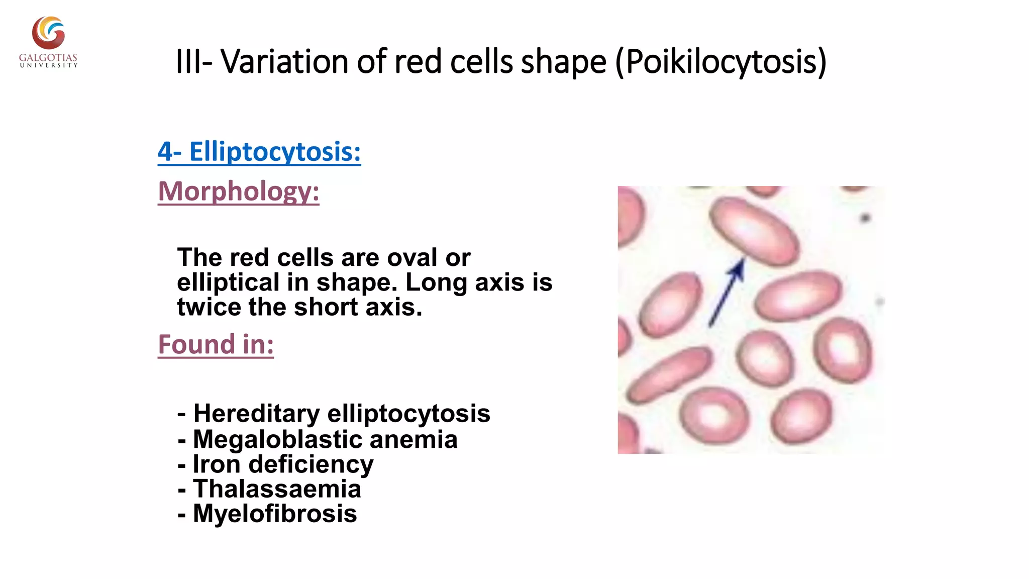 Abnormal morphology of rbc notes | PDF