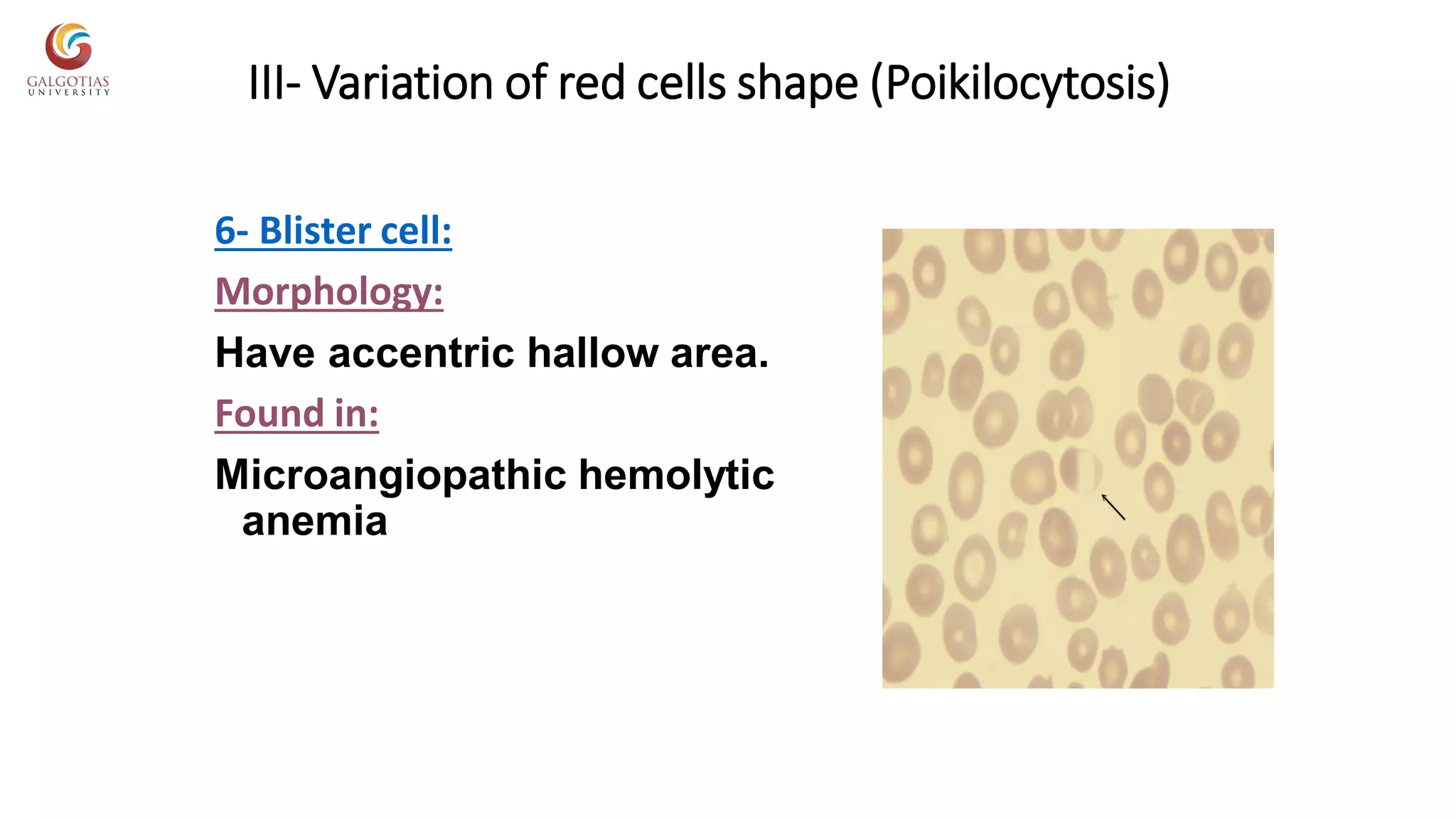 Abnormal morphology of rbc notes | PDF