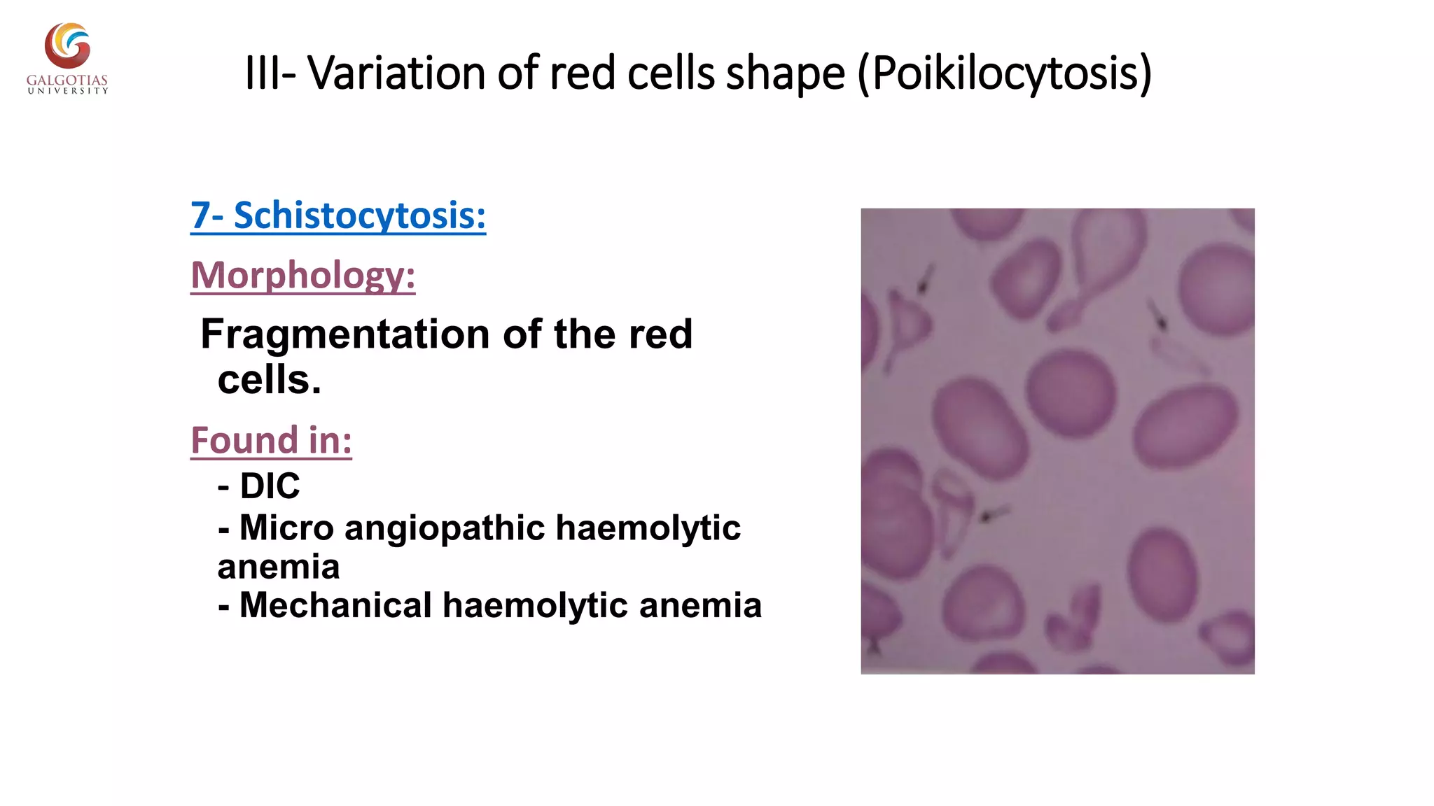 Abnormal morphology of rbc notes | PDF