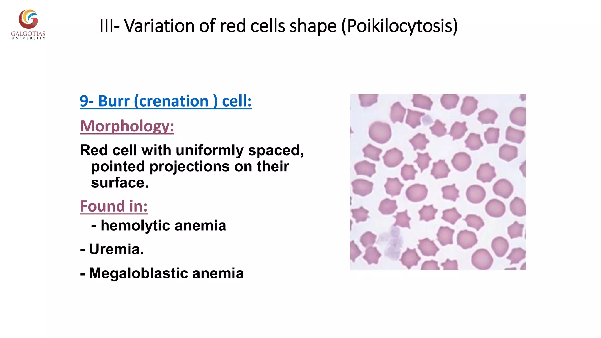 Abnormal morphology of rbc notes | PDF