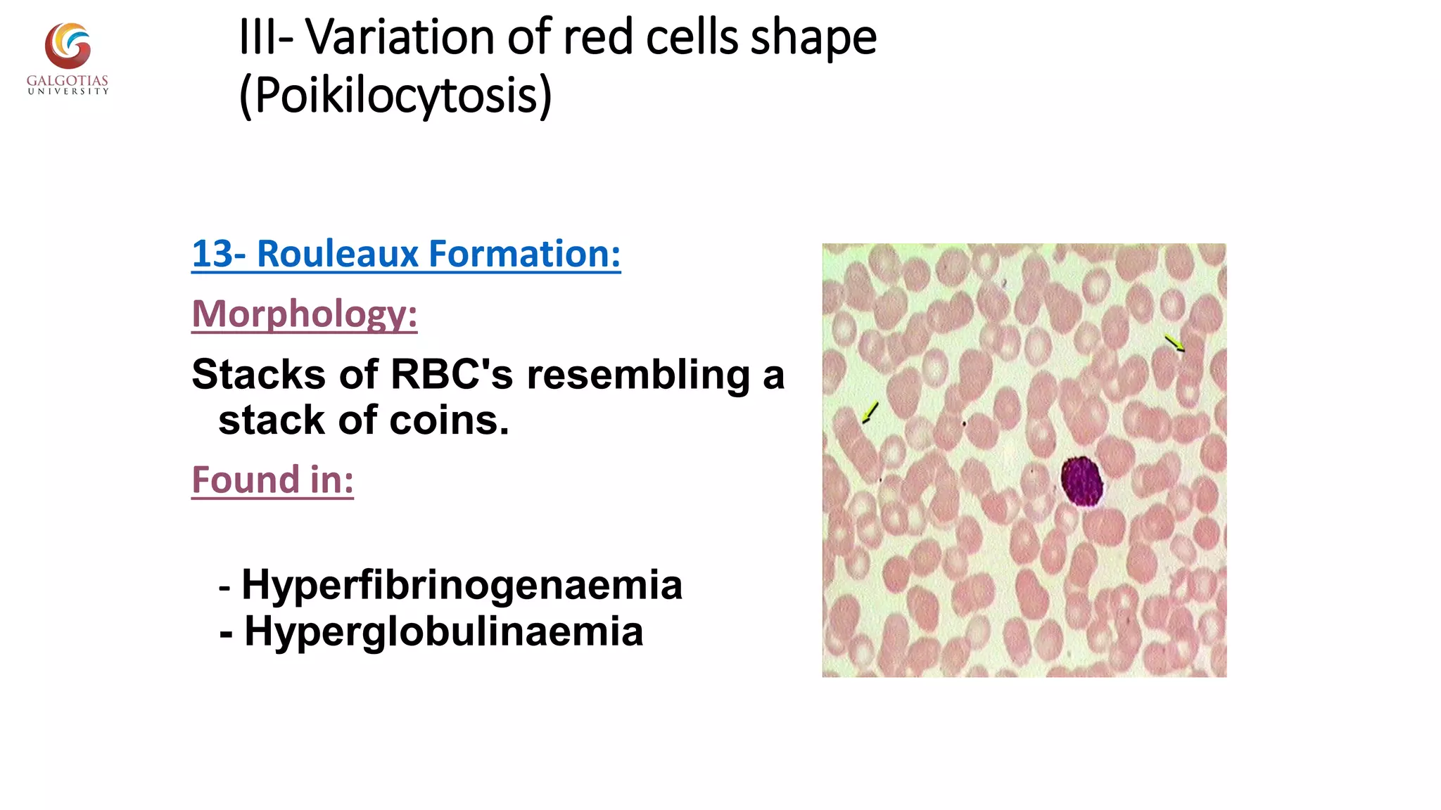 Abnormal morphology of rbc notes | PDF
