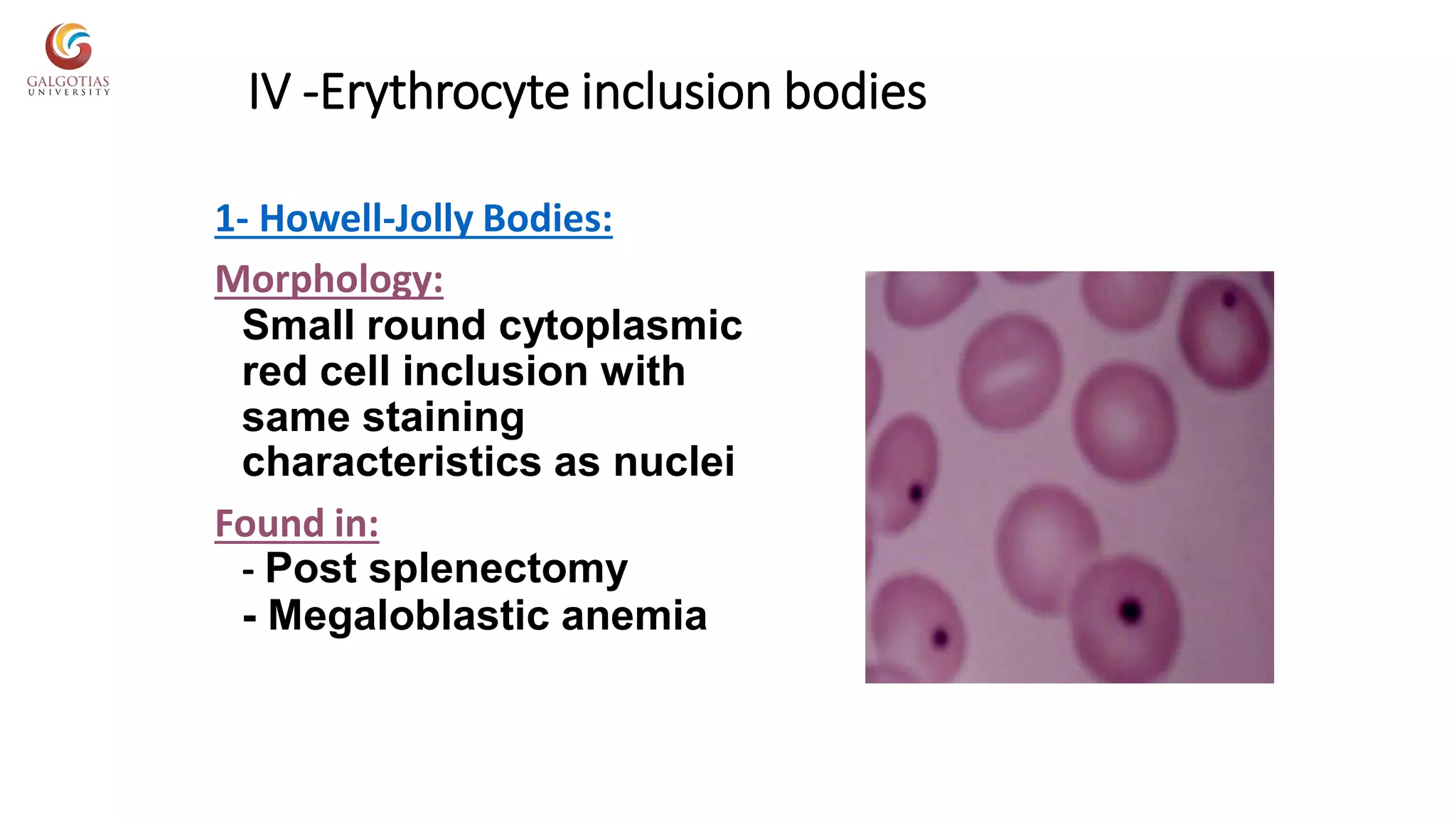 Abnormal morphology of rbc notes | PDF