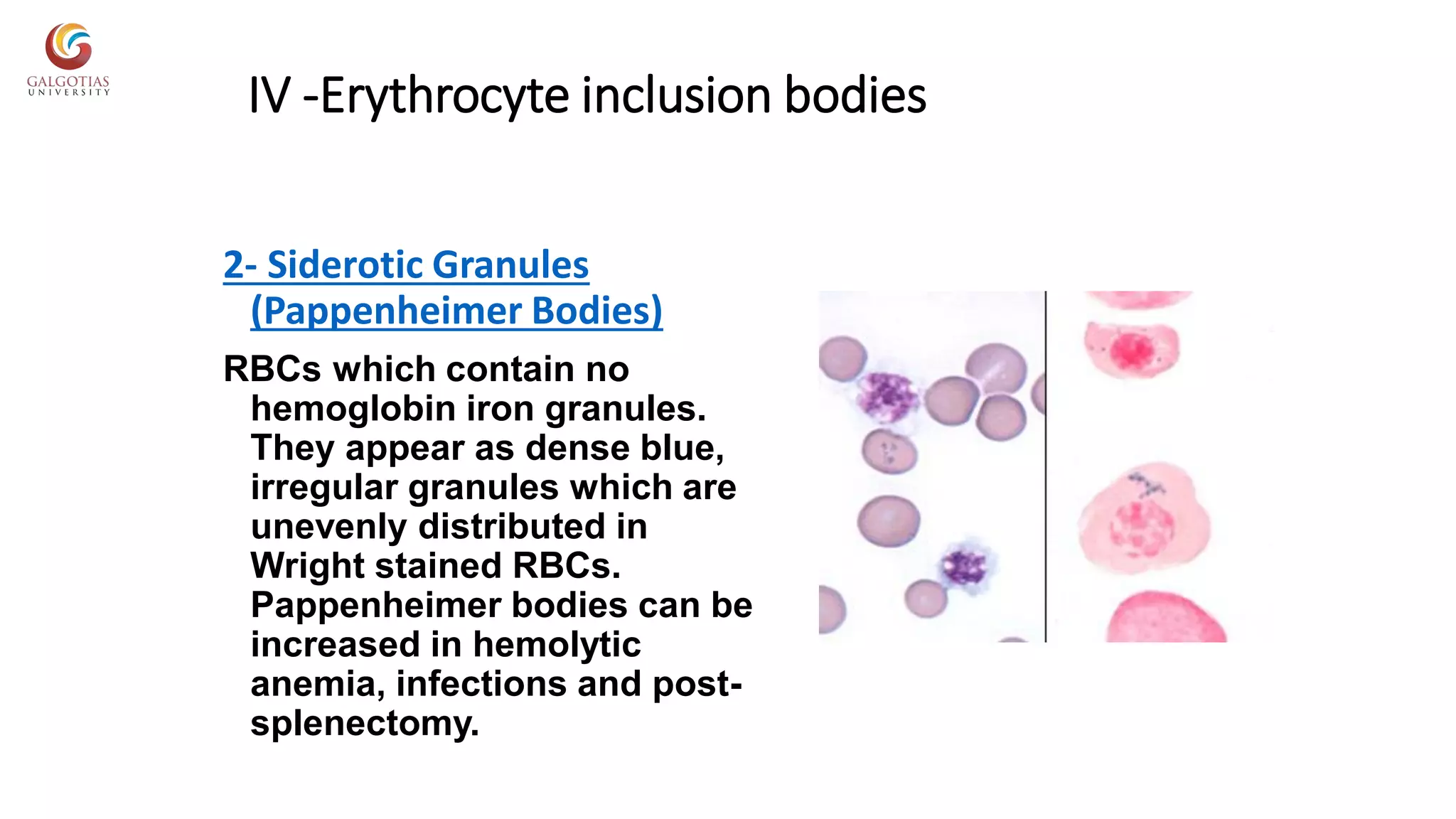Abnormal morphology of rbc notes | PDF