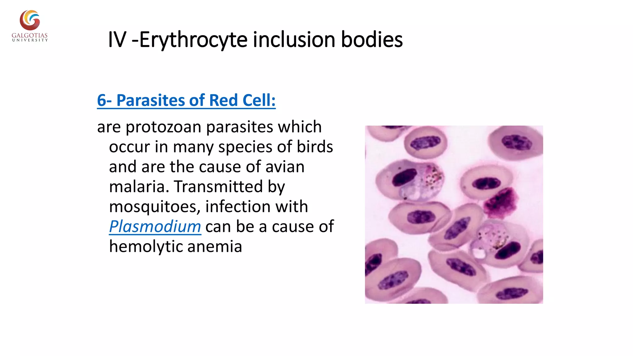 Abnormal morphology of rbc notes | PDF