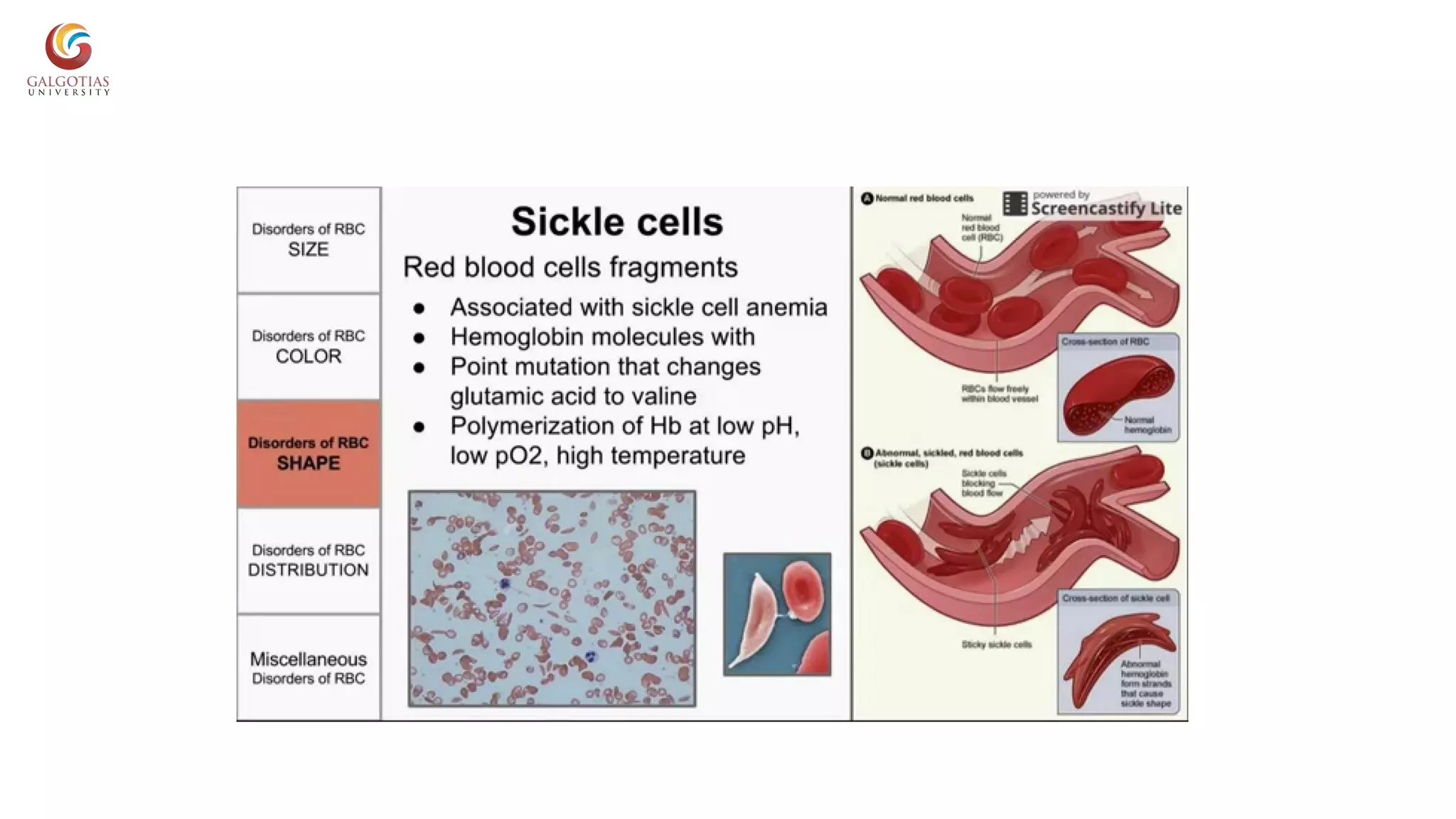 Abnormal morphology of rbc notes | PDF
