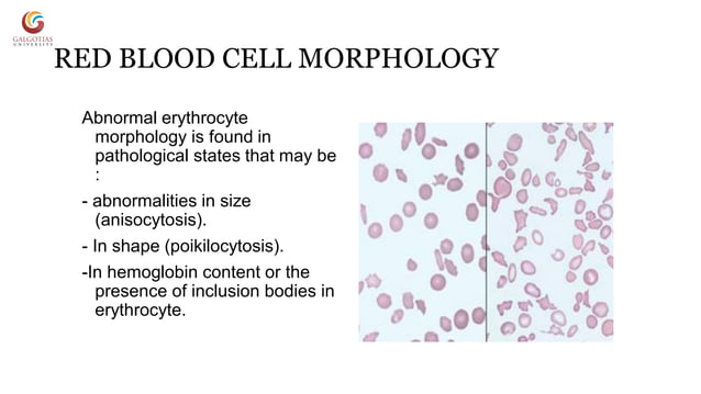 Abnormal morphology of rbc notes | PDF